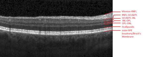 2 An Example Of OCT B Scan From Healthy Retina And The 7 Interfaces To Download Scientific