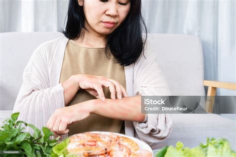 아시아 여성은 새우를 먹은 후 음식 알레르기로 인한 피부 발진과 팔을 긁습니다 식품 알레르기에 대한 스톡 사진 및 기타 이미지 식품 알레르기 알레르기 두드러기 피부