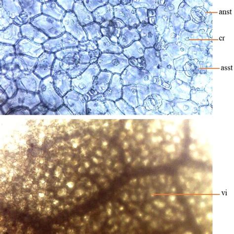 Powdered Leaf Microscopy For L Africana Unstained A À C And Stained