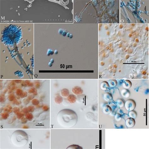 Aspergillus Latus Acc No Mn791110 Colonies Conidiophores
