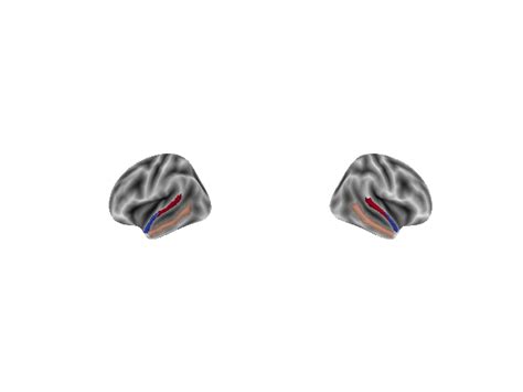 Plot Intracranial Electrodes — Naplib Alpha Documentation