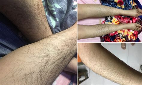 Hairy Teen Legs Porn Sex Photos