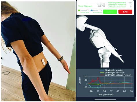 Wearable Sensors Application At The Lumbar Spine Software Download Scientific Diagram