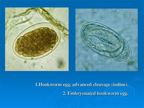 Hookworm Ova