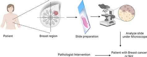 Biopsy Tissue Examination Procedure For Breast Cancer Detection Download Scientific Diagram
