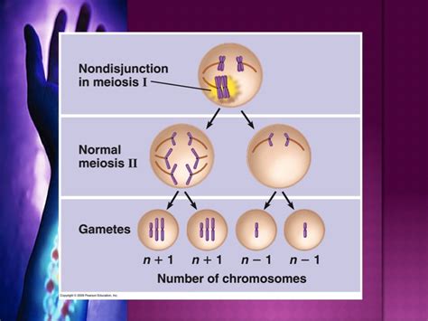 Nondisjunction Definition Explanation Causes And Effects