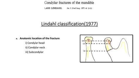 Condylar Fracture Pptx