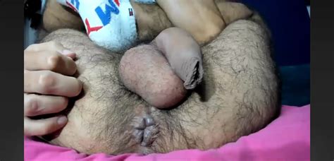 Meaty Hole And Foreskin Thisvid Com