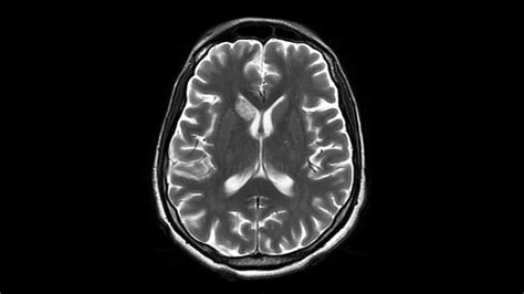 Severe Weakness After Unprotected Sex Page 5