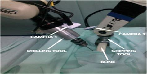 The 6 Dof Robot Manipulator Is Involved In The Drilling Of The Bone And