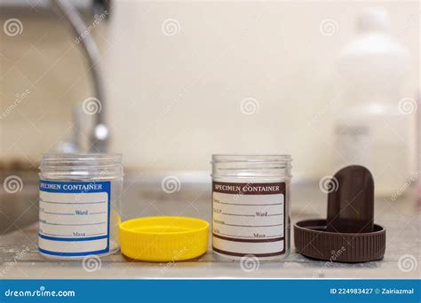 A Specimen Container For Lab Test Stock Image Image Of Health Background 224983427