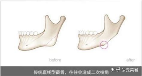 如果杨幂没有选择削骨磨骨，那么她的脸型该怎样调整才能变得更漂亮？ 知乎