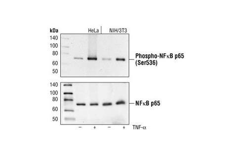 PhosphoPlus® NF-κB p65/RelA (Ser536) Antibody Duet | Cell Signaling ...
