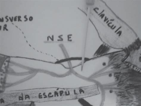 Site Of Introduction Of Anesthetic To Block Efficacy Download Scientific Diagram