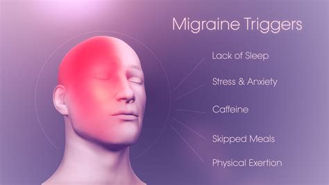 Migraine Triggers Scientific Animations
