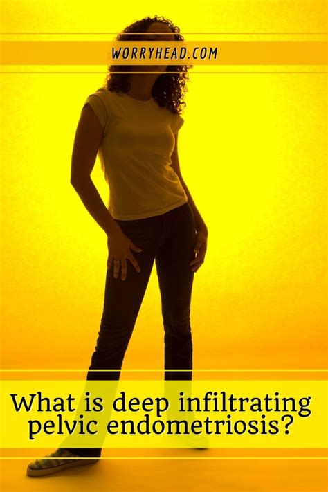 What Is Deep Infiltrating Pelvic Endometriosis Endometriosis Artofit