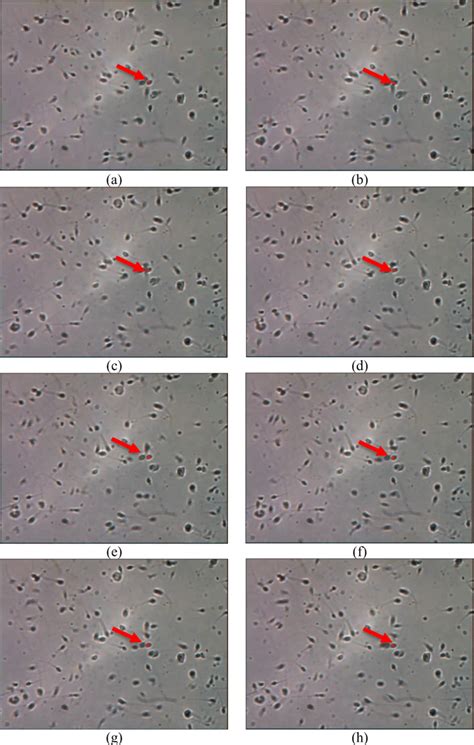 Resultant Image For Sperm 80 In Sample 1 After Applying The Proposed Download Scientific