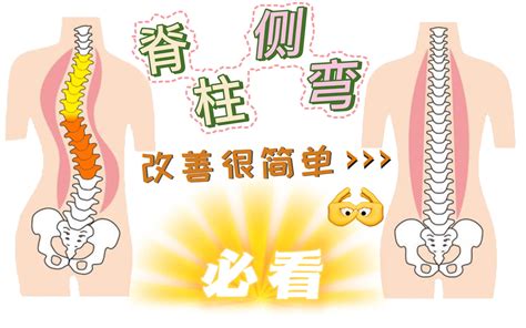 10分钟脊柱侧弯矫正训练调整高低肩长短腿 恢复脊柱中立位 缓解单侧腰膝肩背疼痛脊柱侧弯康复第1步 bilibili B站 无水印