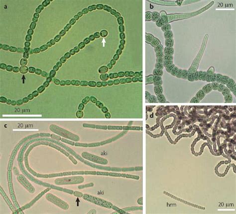 Figure 11 From Fixed Nitrogen Dynamics And Heterocyst Patterning In