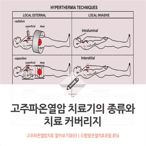 고주파온열암 치료기의 종류와 치료 커버리지 네이버 블로그