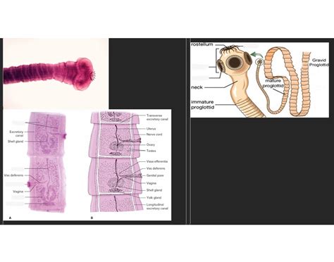 Tapeworm Anatomy Quiz