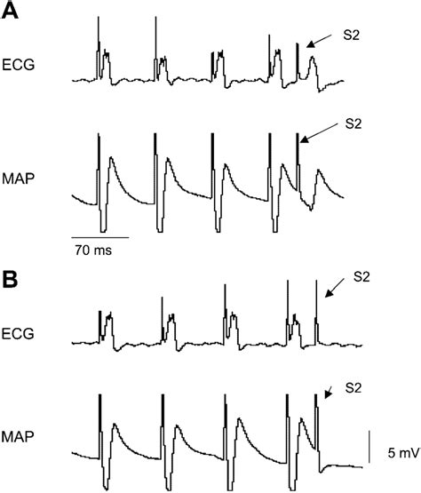 ECG And MAP Recordings From A TG Mouse During Ventricular Effective Download Scientific Diagram