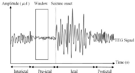 Four Different EEG Segments Download Scientific Diagram