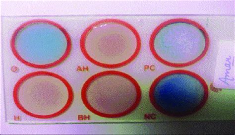 Slide Agglutination Test Procedure