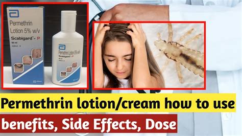 Permethrin Lotion How To Use At Peggy Rios Blog