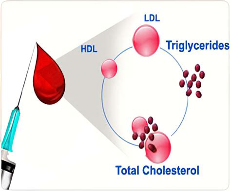 Lipid Profile