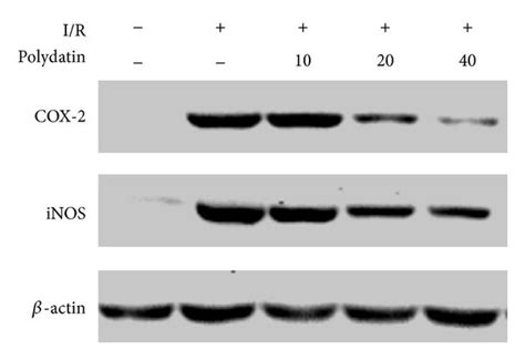 pi3k akt pathway was involved in polydatin attenuated expression of the