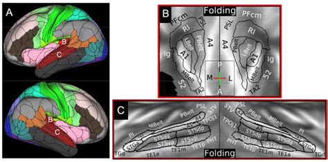 Auditory Cortex Mri