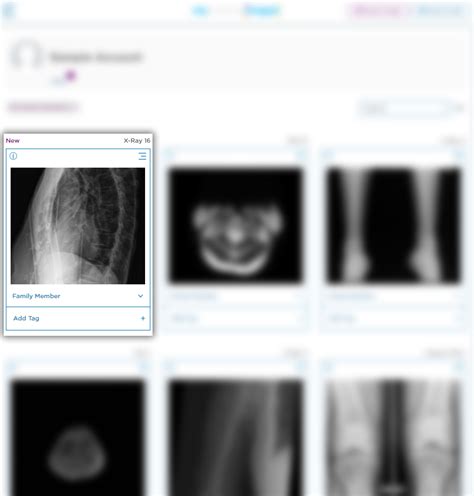 uploading dicom images