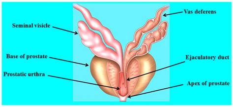 Reduction Of Prostate Cancer Risk Role Of Frequent Ejaculation