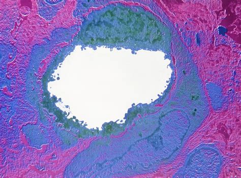 Capillary Cross Section Photograph By Cnriscience Photo Library Pixels Merch