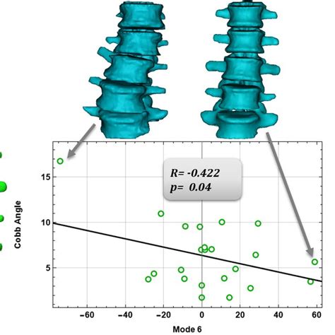 Correlation For The Vertebral Body Of Mode 6 And Cobbs Angle
