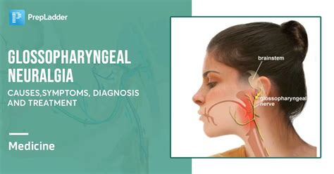 Glossopharyngeal Nerve Full Size Picture Glossopharyngeal Nerve 