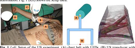 Figure 1 From Validating An Svr Based Correlation Algorithm On Human Volumetric Ultrasound Data