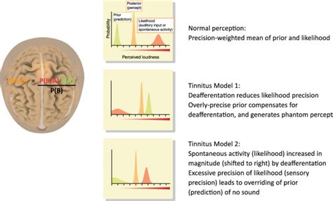 The Bayesian Brain And Tinnitus Springerlink