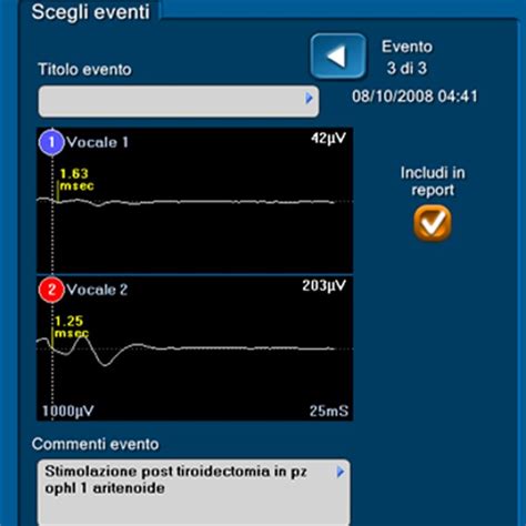 Recurrent Laryngeal Nerve Electric Response Download Scientific Diagram