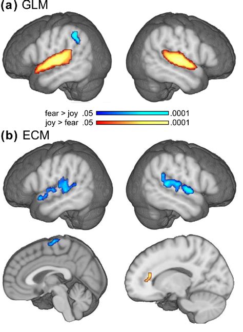 Figure 1 From The Auditory Cortex Hosts Network Nodes Influential For