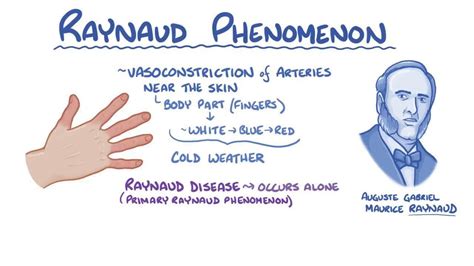 Raynaud Phenomenon Video Causes And Meaning Osmosis