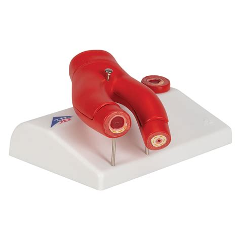 3b Scientific Arteriosklerose Modell G40 Mit Querschnitt Der Arterie