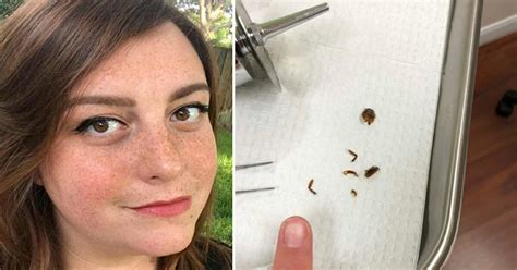 Woman Wakes Up With Strange Feeling In Ear After Days Doctors Find This
