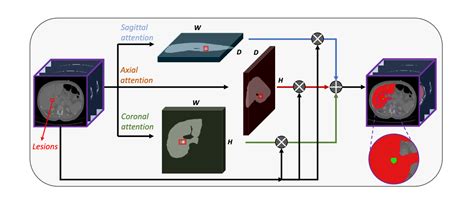 Transformers For 3d Medical Image Segmentation At Susan Callahan Blog