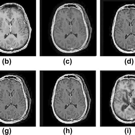 A B A Multimodal Pair C The Ramlal Et Al 2019 Result D The Download Scientific Diagram