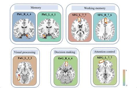 Figure Brain Areas With The Most Discriminative Ability Between Groups Download Scientific
