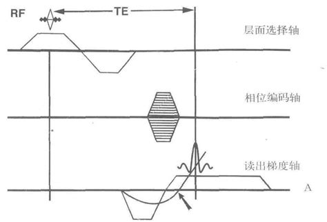 二维 2D TOF MRA 体部成像的正常变异 医学