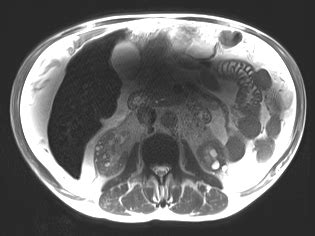 Dielectric Effect Questions And Answers In Mri