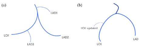 Identification Of Lcx And Lad A Different Combinations Of Lad And